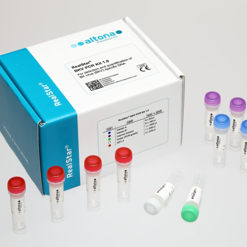 RealStar® Pneumocystis jirovecii PCR Kit 1.0 – BIOSORIN (PRIVATE) LIMITED
